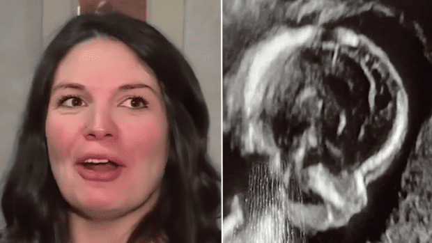 Alabama Mom Born With Ultra-Rare Double Uterus Has One in a Million ...