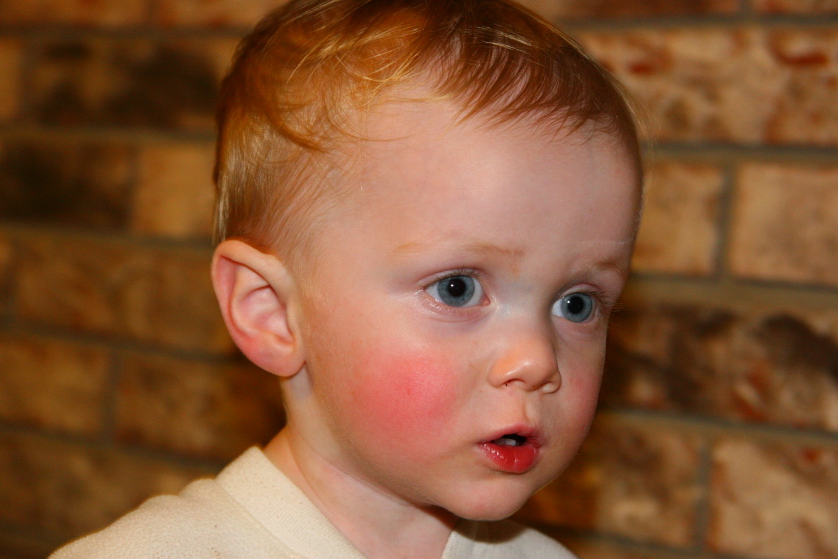 How to Reduce a Child's Fever - WeHaveKids