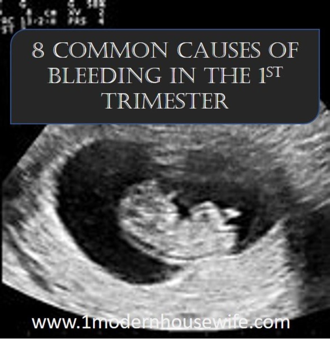 8 Common Causes for Bleeding in the First Trimester - WeHaveKids
