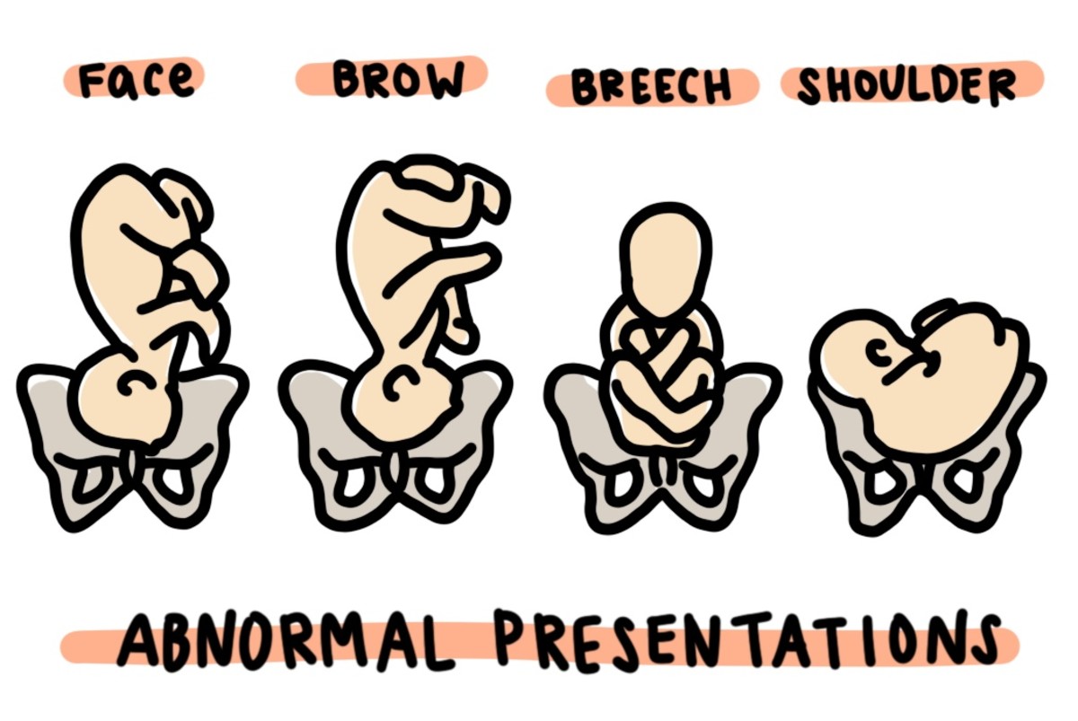 What to Expect in the 39th Week of Pregnancy - WeHaveKids