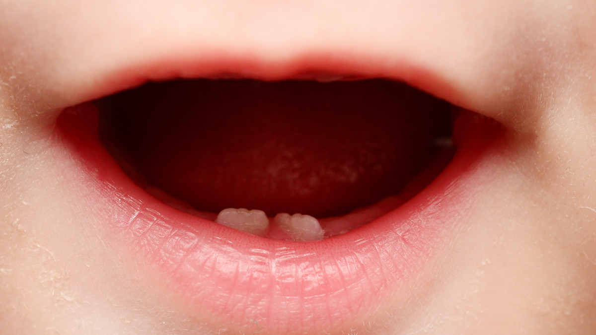 Newborn’s Wiggly Natal Teeth Cause Stir on Social Media - WeHaveKids News