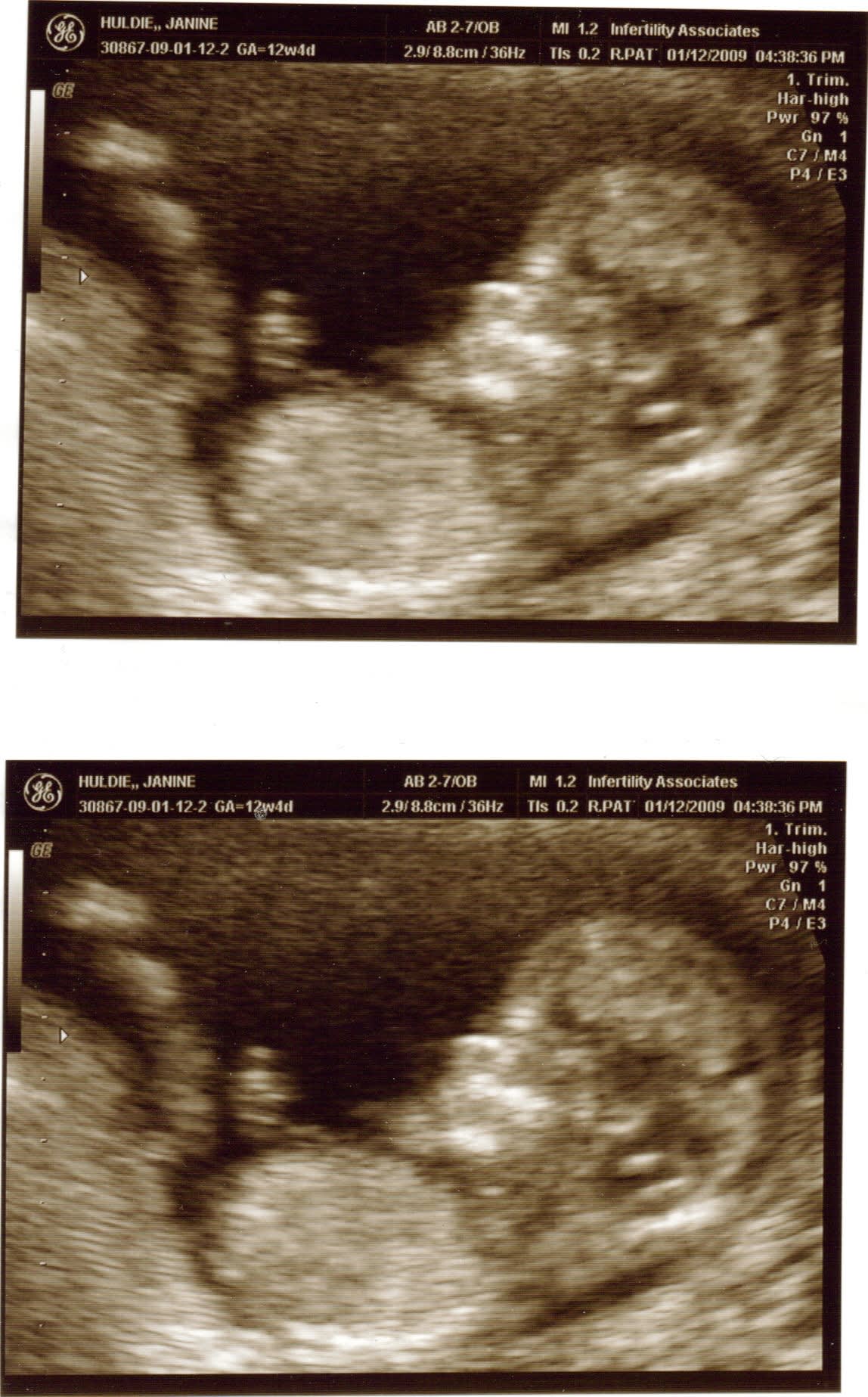 21 week scan boy